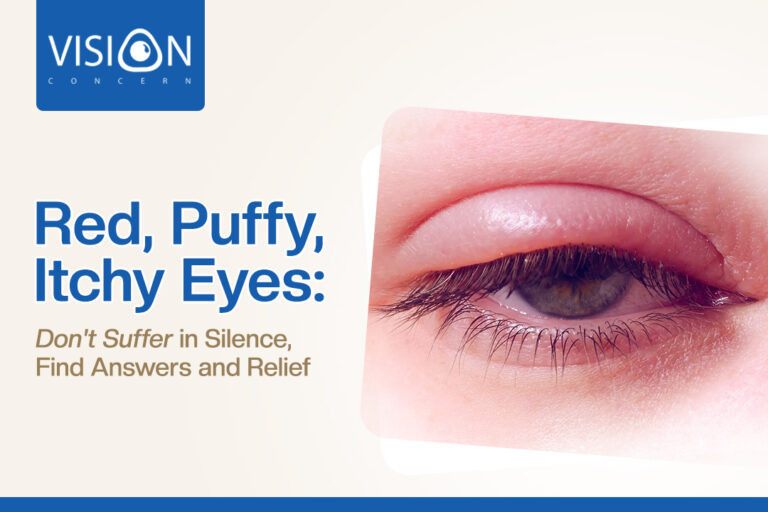 Itchy Eyes 4 Common Causes And How To Treat Them