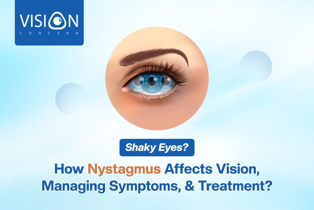 Understanding Nystagmus: Causes, Symptoms, Treatment Options