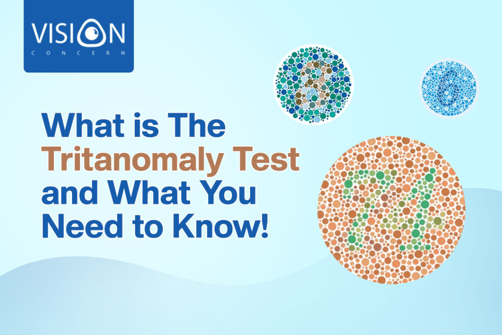 Tritanomaly Test: Check Your Blue-Yellow Color Vision